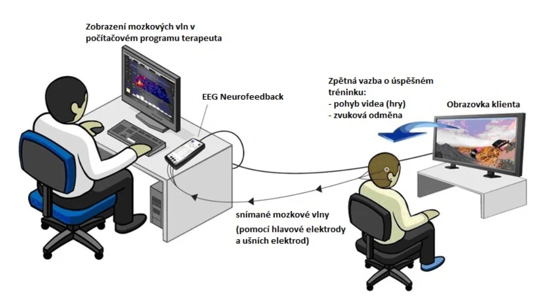 Neurofeedback Terapia pre Zlepšenie Mentálneho Zdravia a Výkonu | ČR a SK